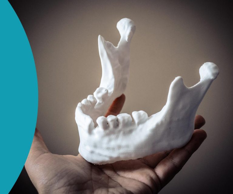 Submandibular gland removal - Head And Neck Surgery London